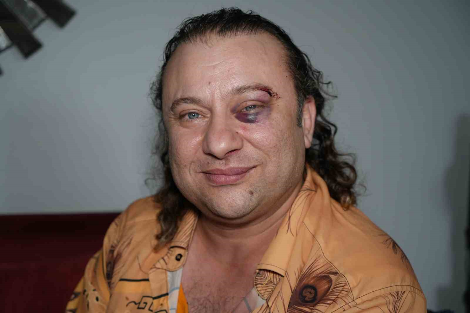 Şarkıcı Onur Akay saldırıya uğradı